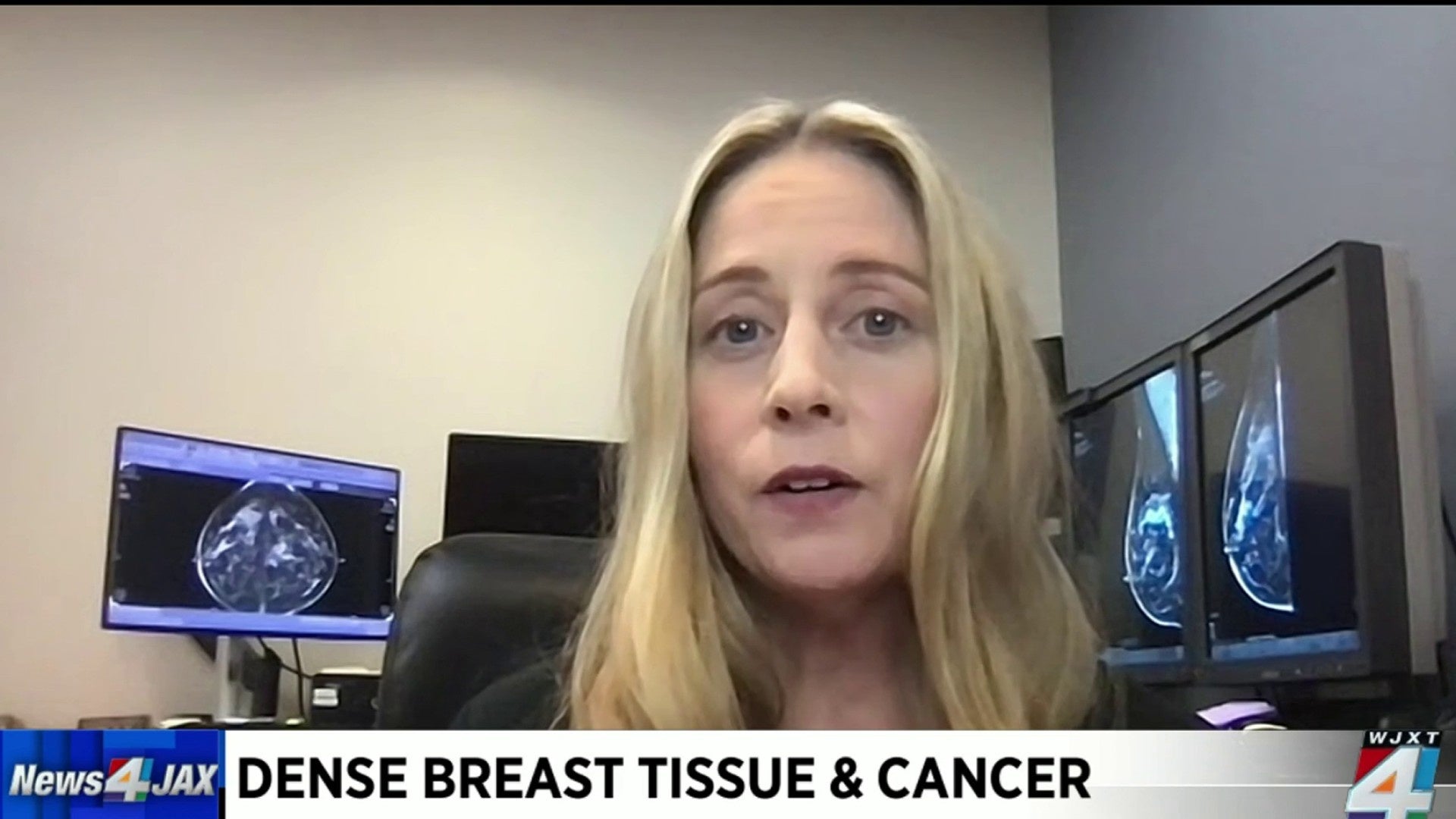 What you need to know about dense breast tissue